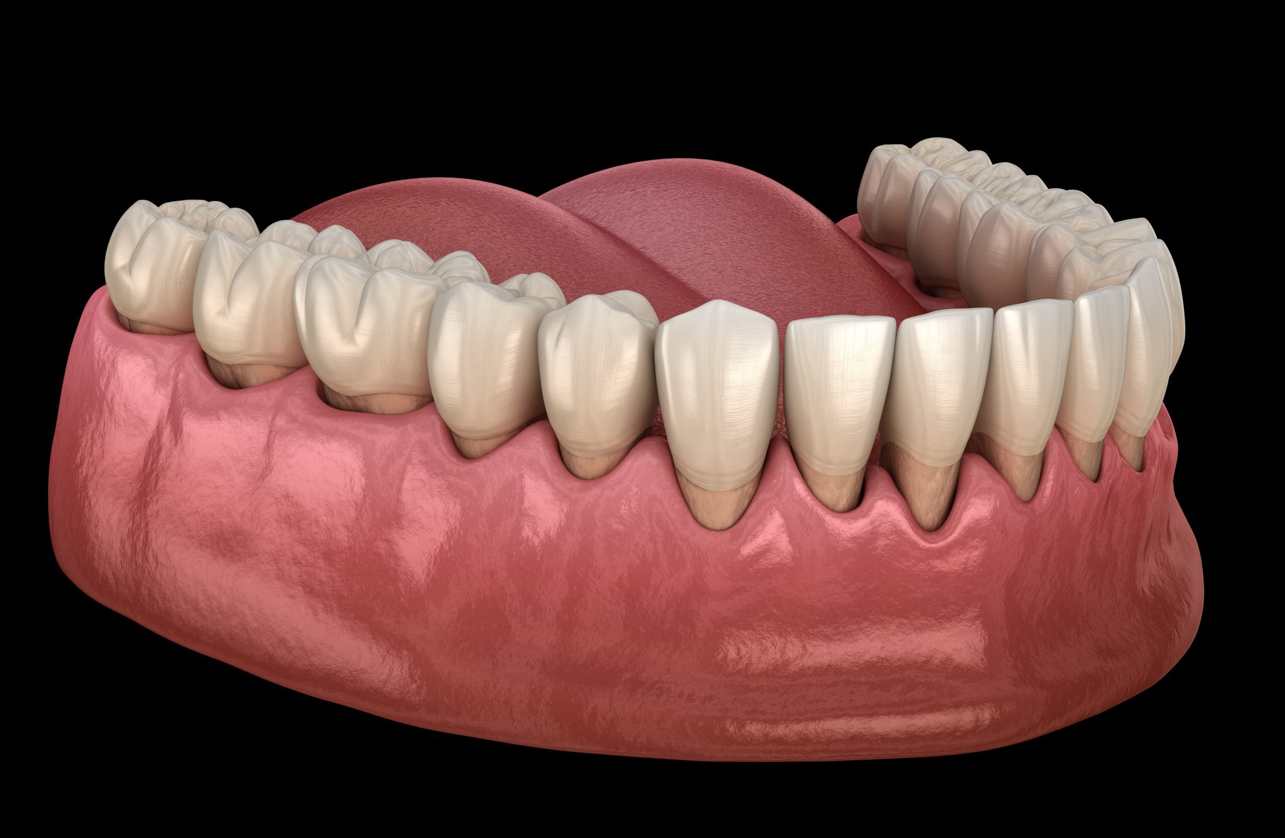 Periodontologia - Centro Clinico Aguas Livres